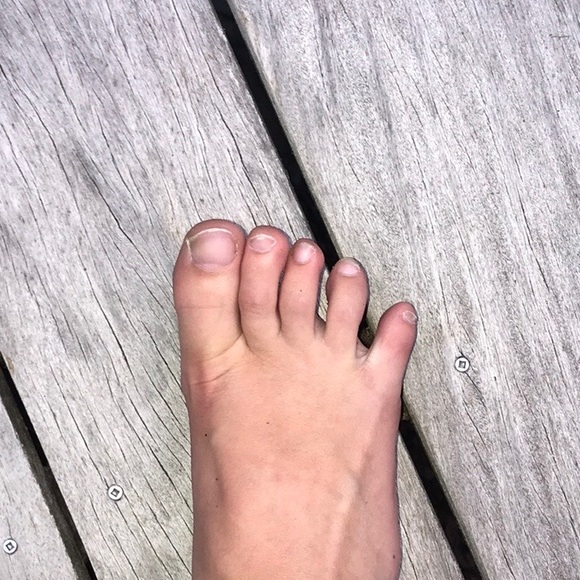 Other | Big Fat Juicy Toes | Poshmark